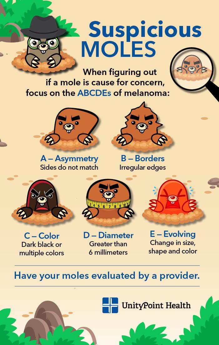 Suspicious skin moles