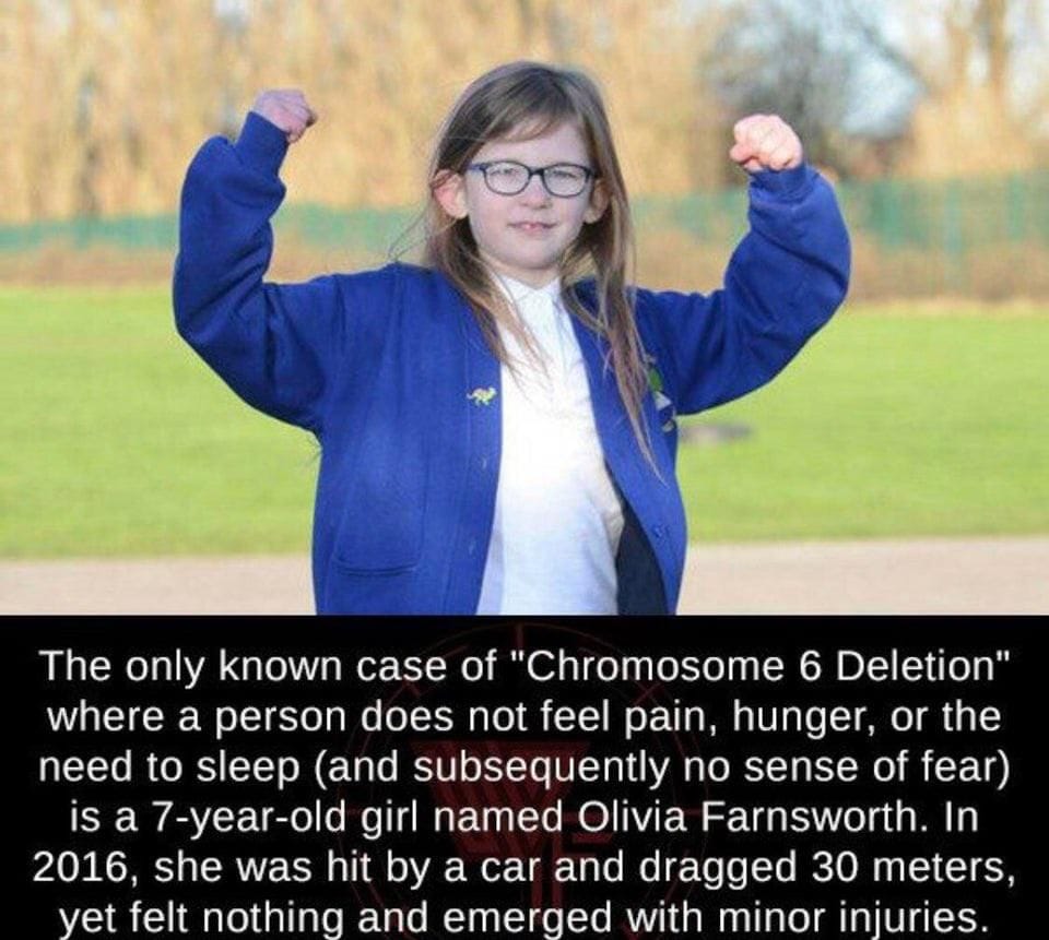The girl cursed with the inability to feel physical pain. She rarely ...