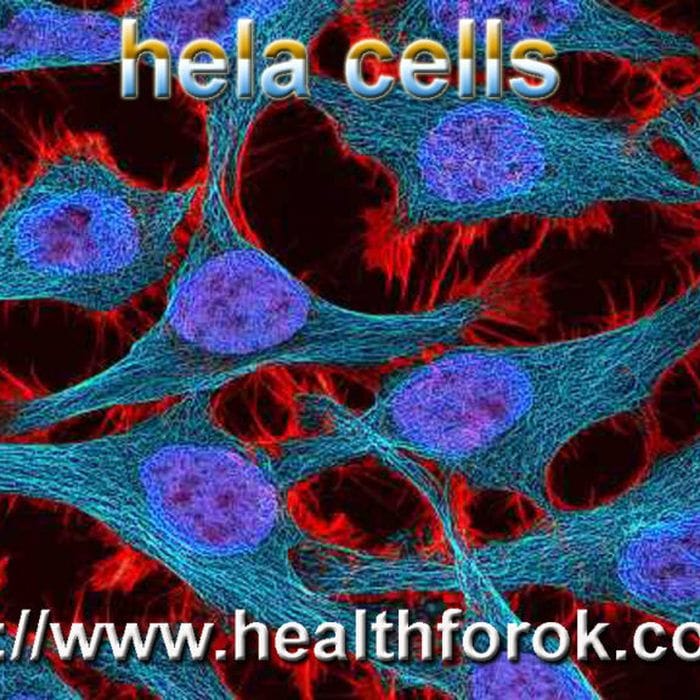 Hela cells Origin of this important cell line in life science research