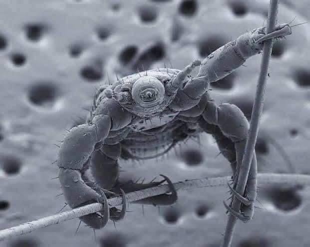This is what a louse looks like clinging to the scalp, seen through a ...