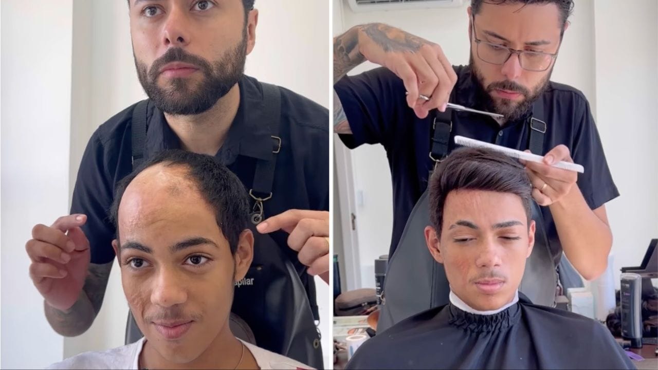 Generous Hair Aesthetician Creates New Wigs for Burn Victims and ...