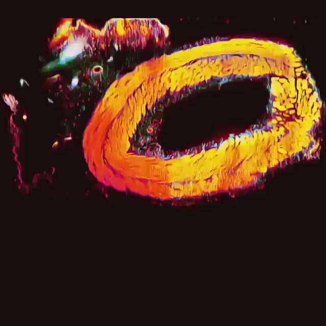 This cross section footage of a mouse's aorta reveals outer layers of ...