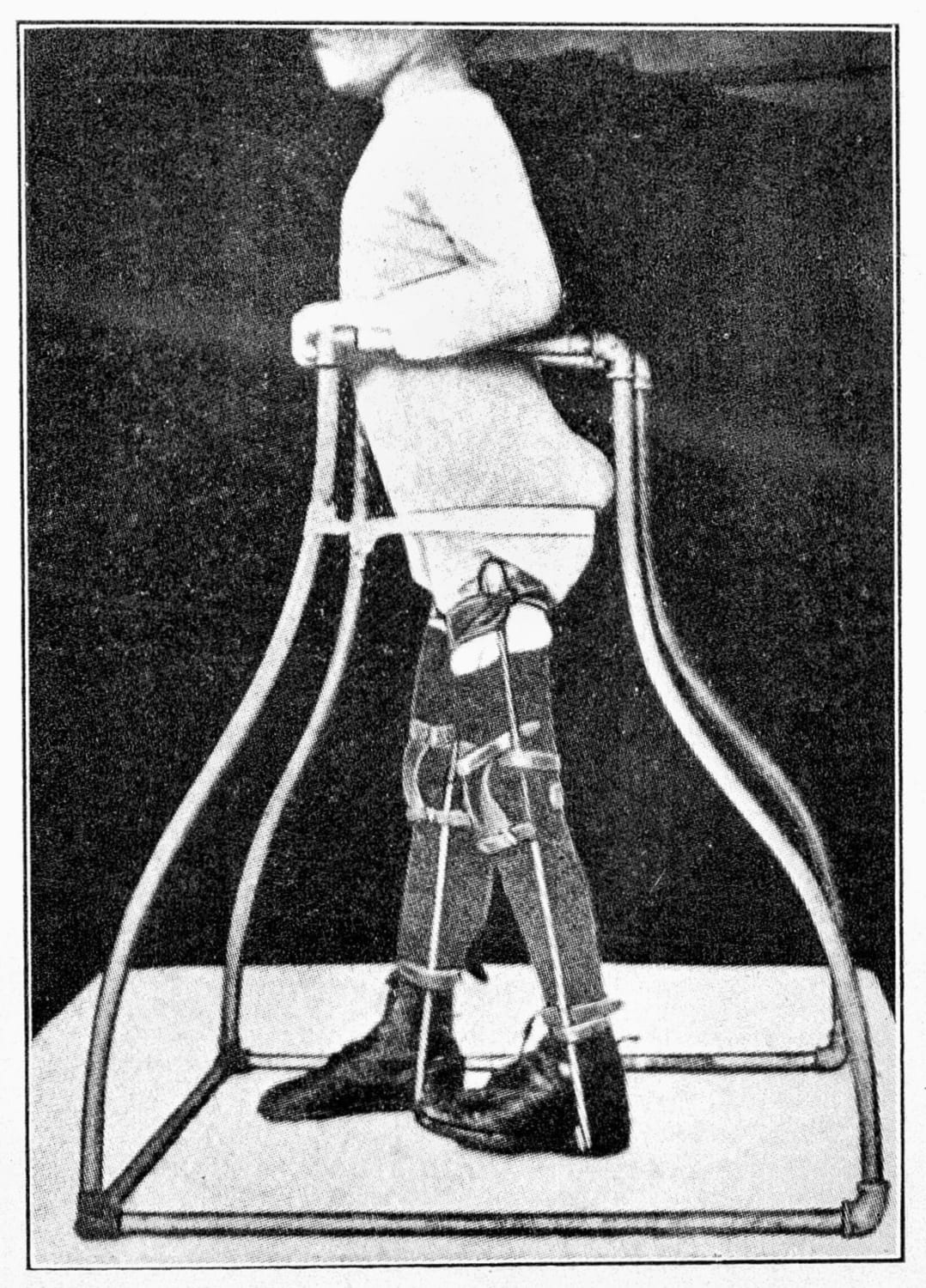 FIG. 16. — Paralyzed child strapped in a walking frame wearing splints ...
